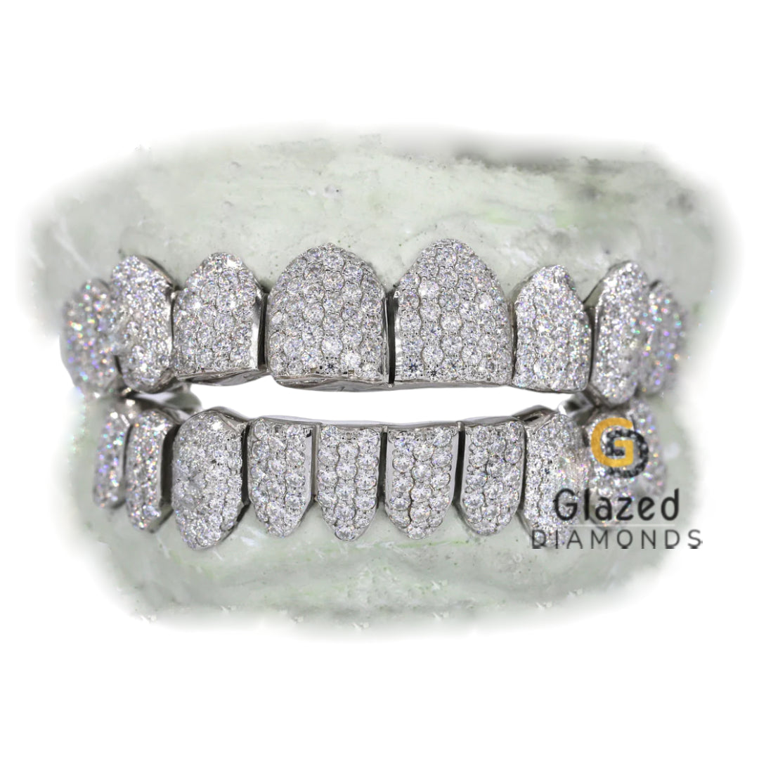 VVS Moissanite Diamond Custom Grillz – Glazed Diamonds